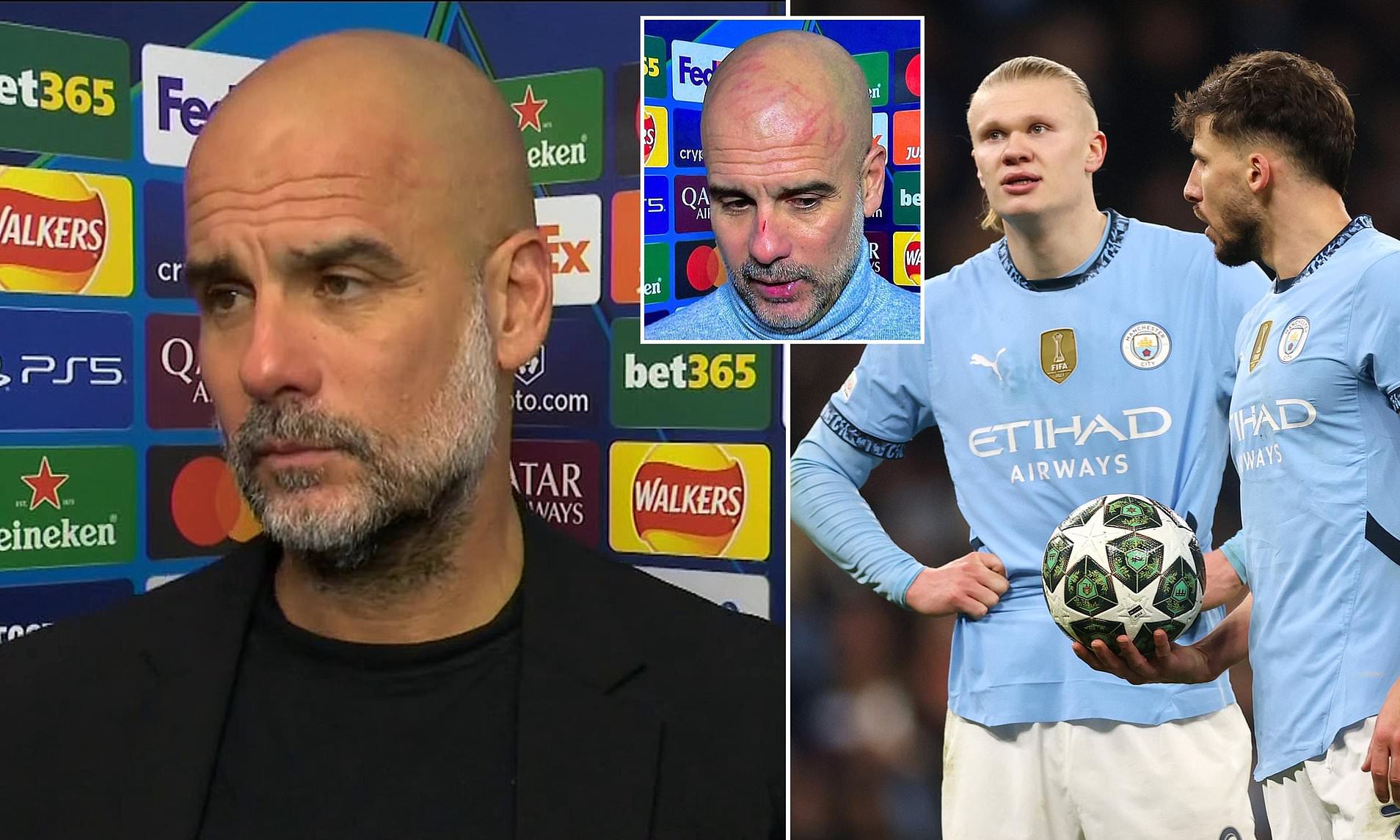 Pep Guardiola spotted with scratches on his head for the THIRD time ...