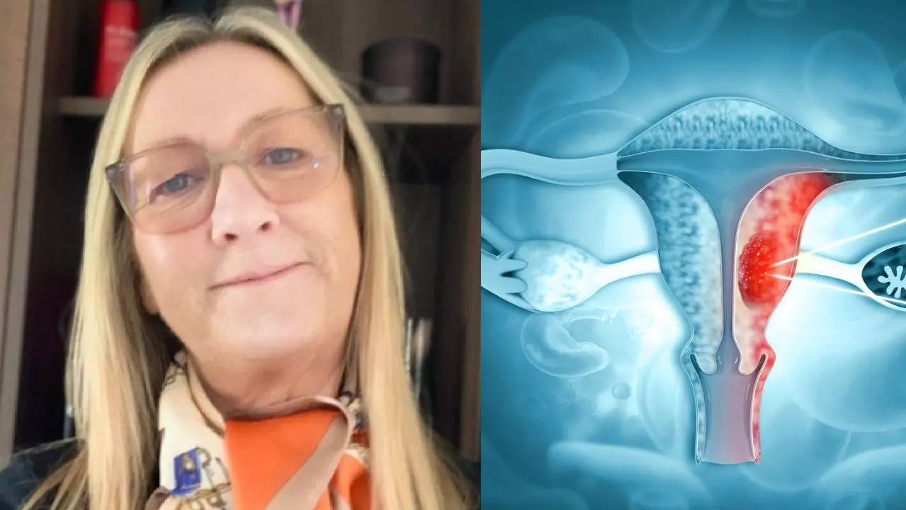 Menopause or cancer? 58-year-old woman ignores symptoms and receives a ...