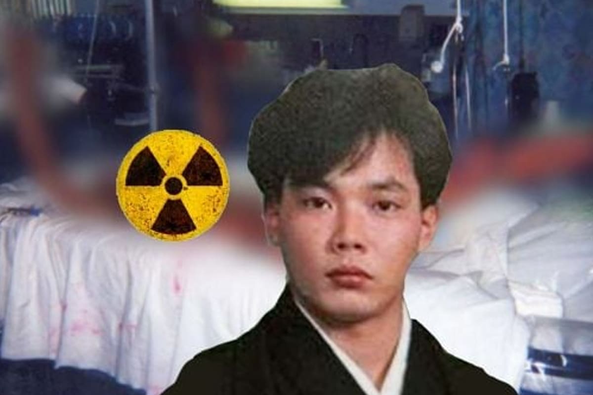 Who Is Hisashi Ouchi: The Man Who Endured the Most Horrific Radiation ...