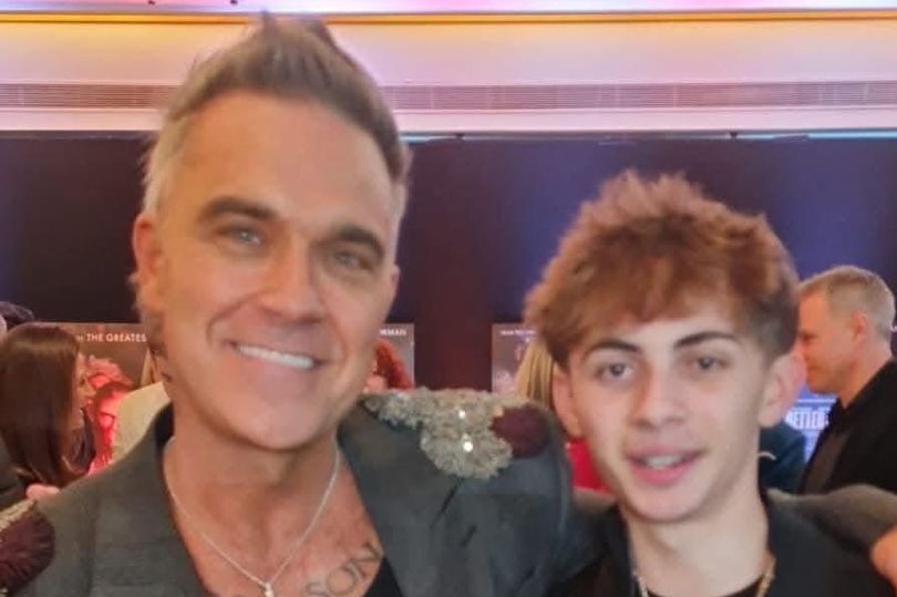 Nottingham actor has first major role in Robbie Williams film Better Man