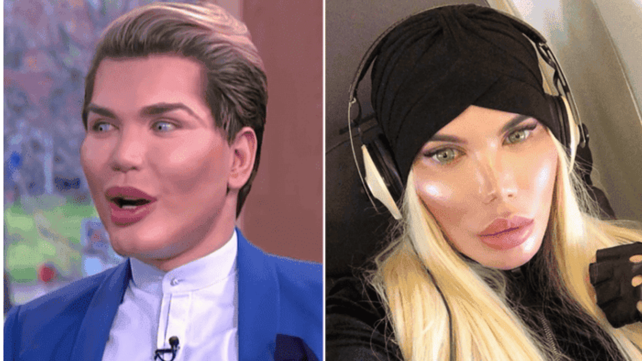 The Story of a Human Ken Doll with a Plastic Surgery Addiction