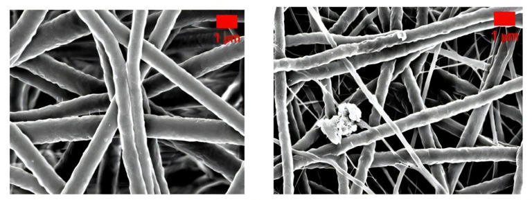 Scientists develop magnesium-enriched nanofiber patches for safer wound ...
