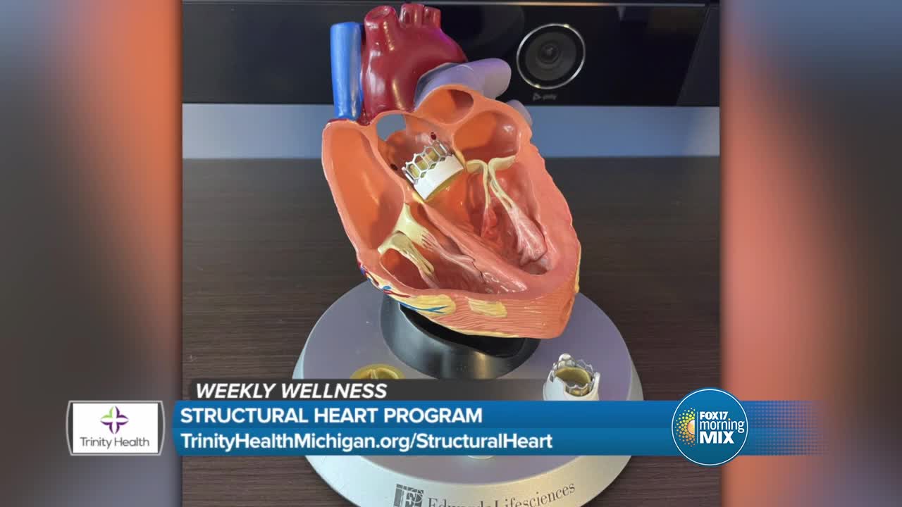 Weekly Wellness: Trinity Health's Structural Heart Program