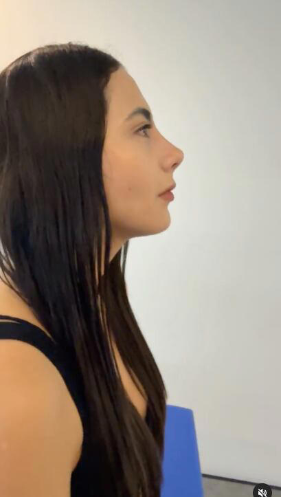 Tami Rivera se operó la nariz y parece otra persona; así luce ahora