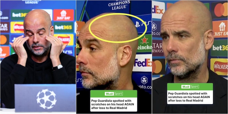 Guardiola devastato, rispuntano i graffi in testa dopo la sconfitta ...