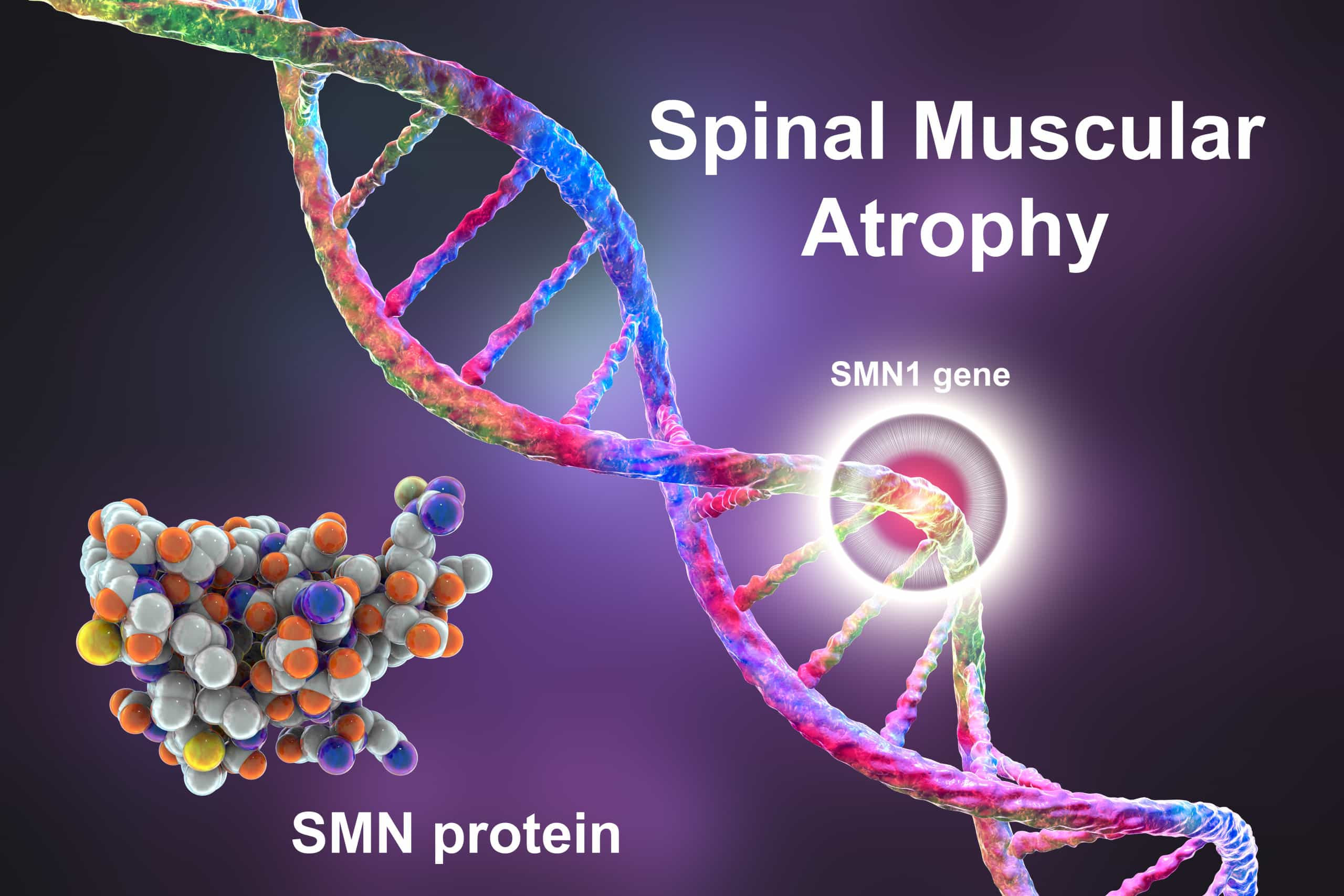 Understanding the effects of spinal muscular atrophy