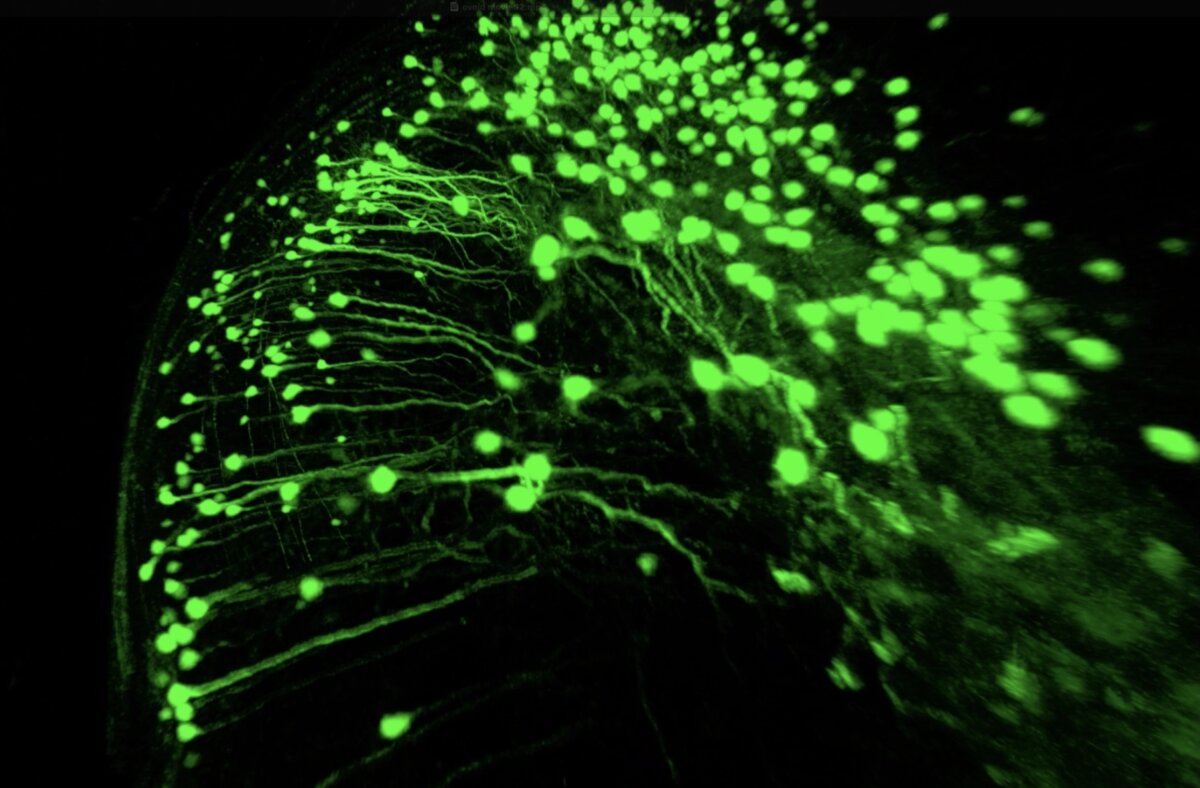 These newly discovered unusual brain cells solve memory mystery