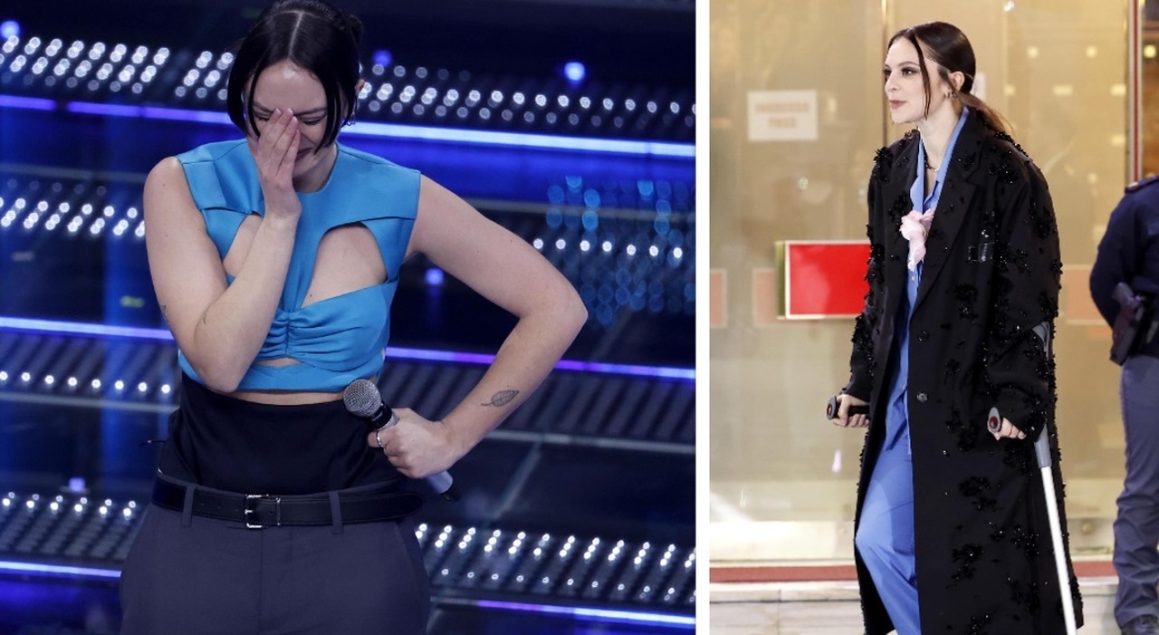 Francesca Michielin dopo la caduta e senza stampelle, il trucco della ...