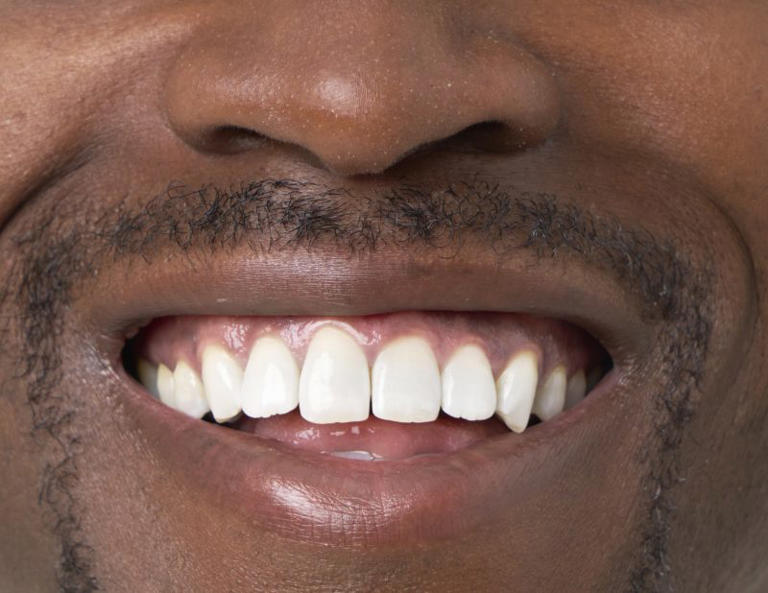 Good teeth matter when it comes to self-confidence