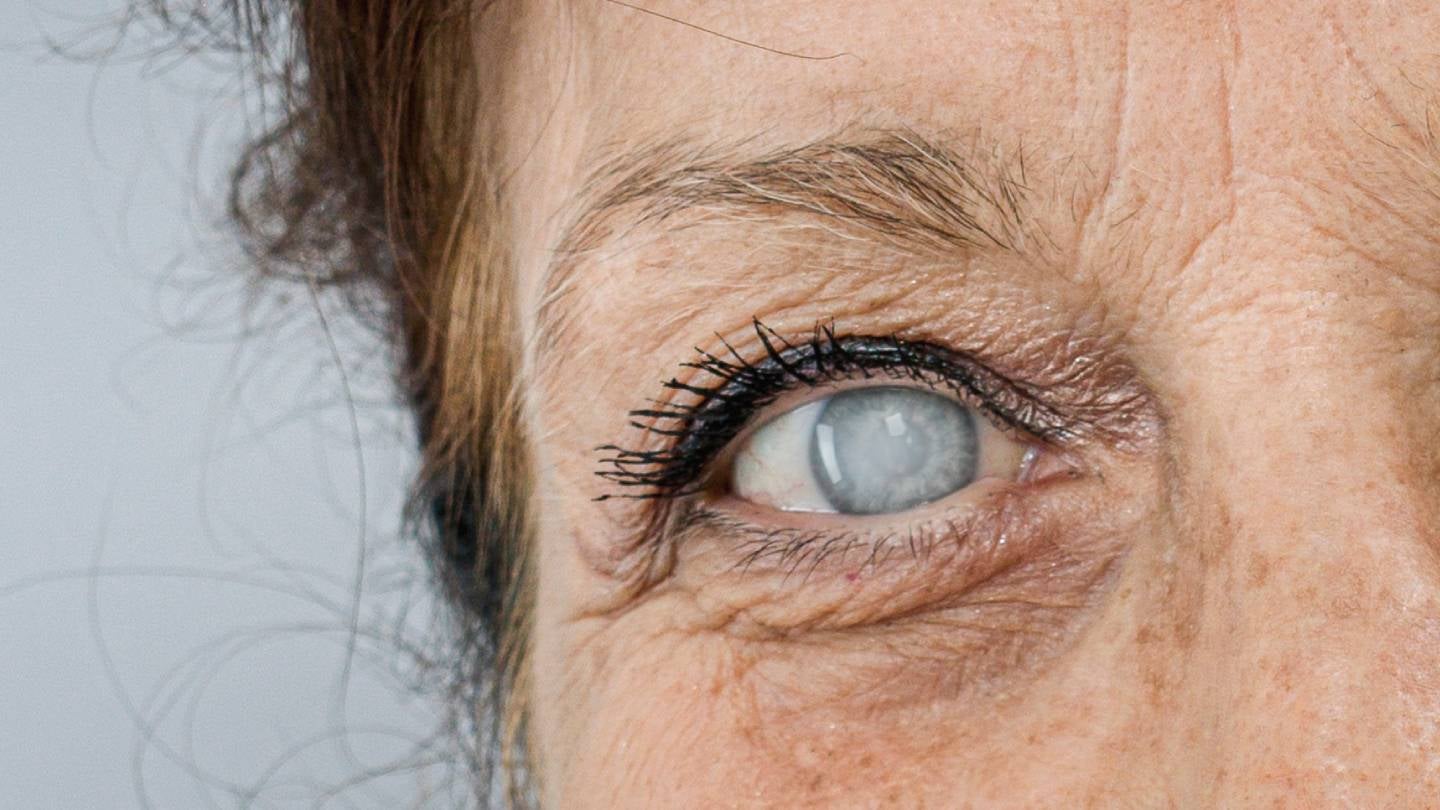 GenSight’s Optic Neuropathy gene therapy sustains efficacy over five years