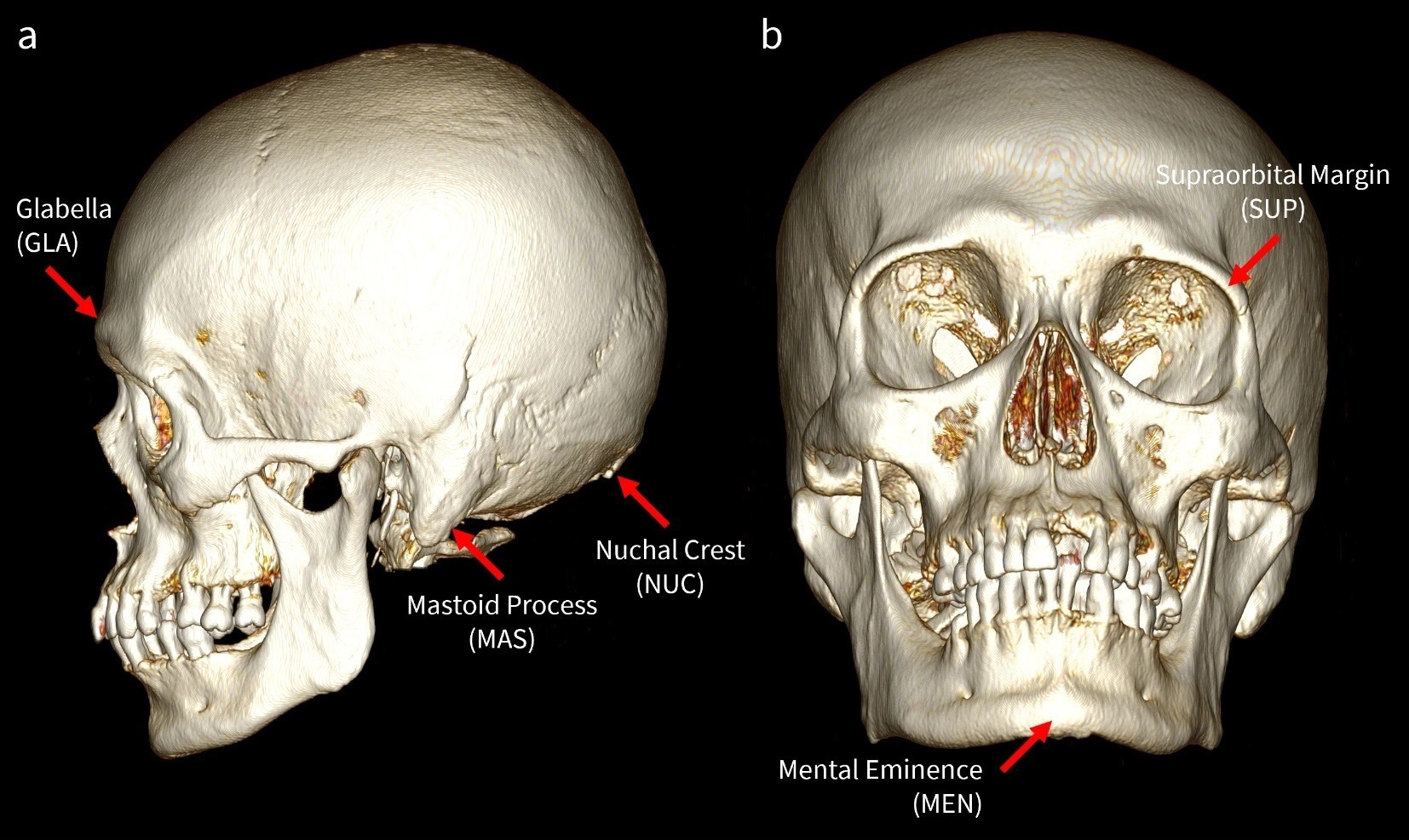 New AI Tool Dramatically Improves Forensic Skull Identification