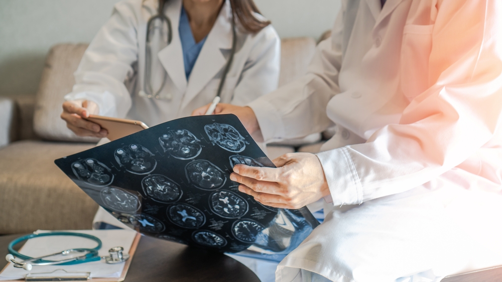 Doctor reveals 5 warning signs of aggressive brain cancer