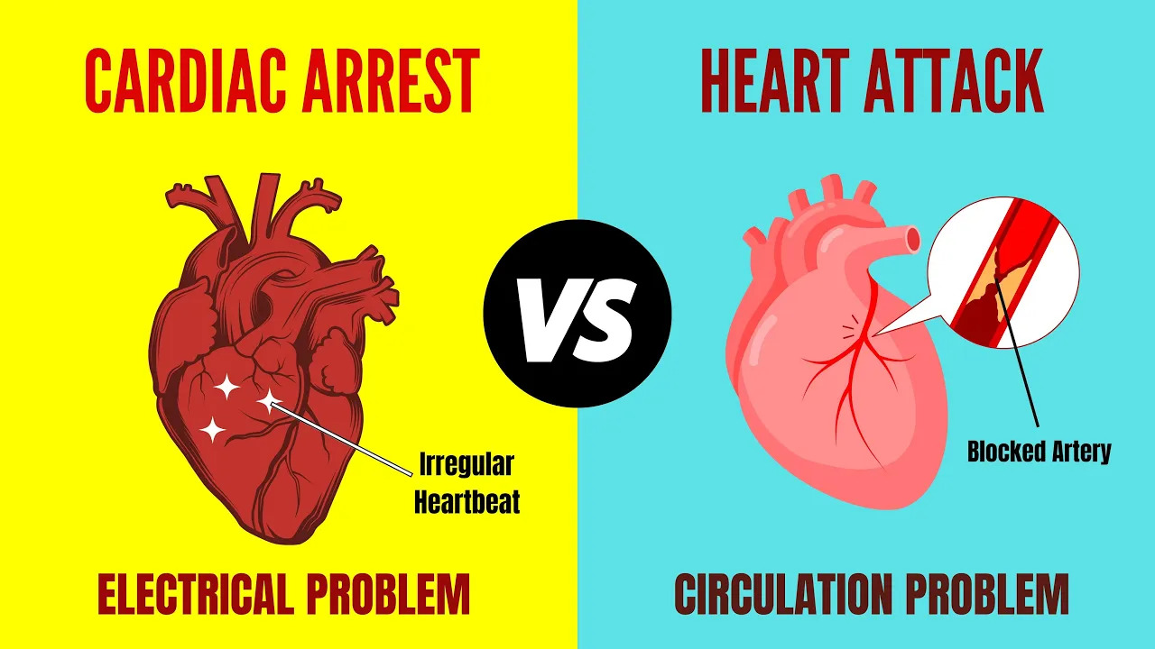 Cardiac Arrest Vs Heart Attack Everything You Need To Know