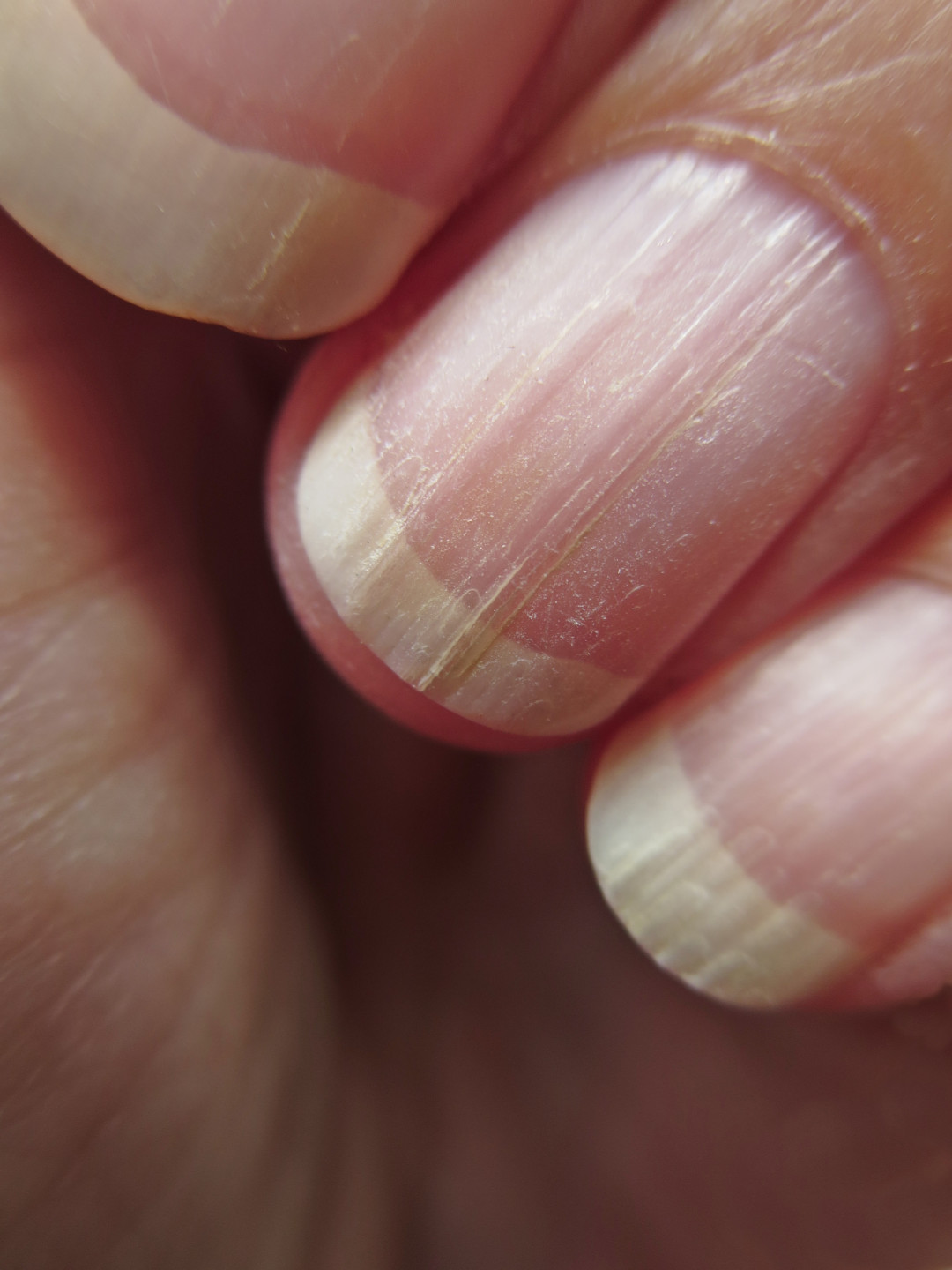 What your nails say about your health