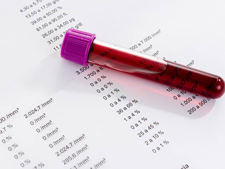 Kleines Blutbild, großes Blutbild: Diese Werte werden untersucht