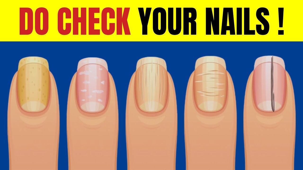 9 Things Your Nails Can Tell You About Your Health