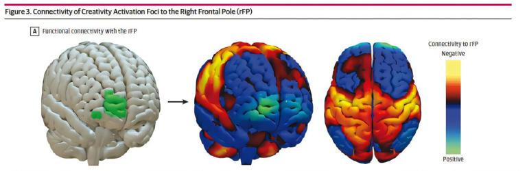 MRI mapping identifies a brain circuit for creativity