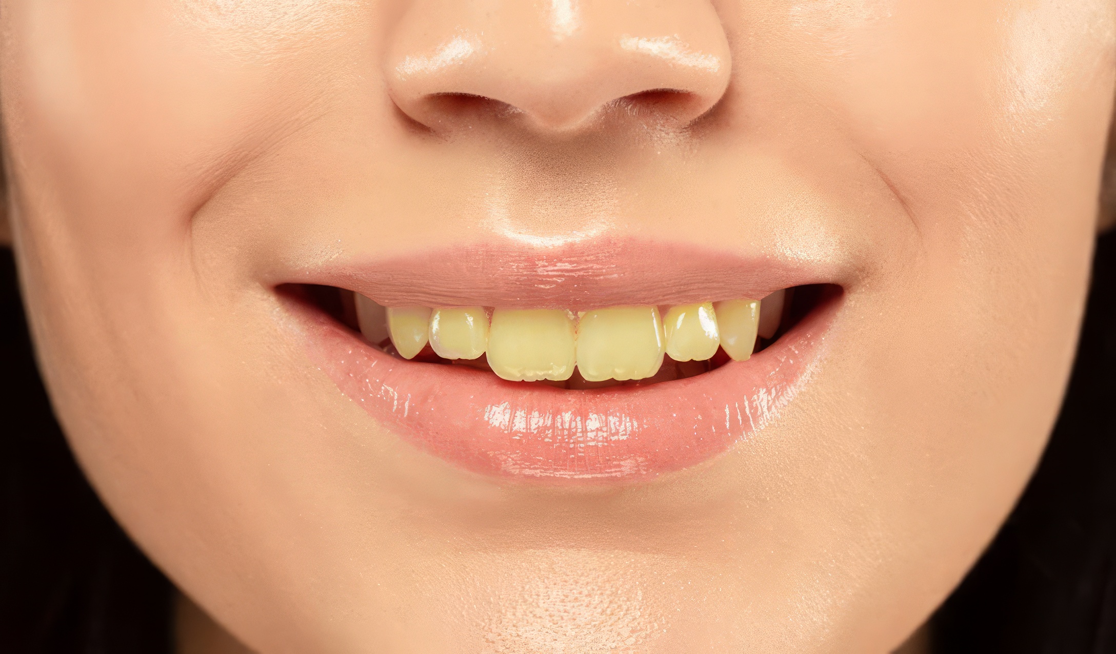 Pourquoi vos dents sont-elles jaunes même si vous les brossez ? – Un ...