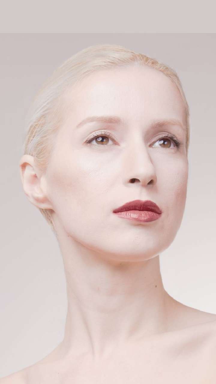 Frequent Headaches To Pale Skin, Check Signs Of Vitamin B12 Deficiency