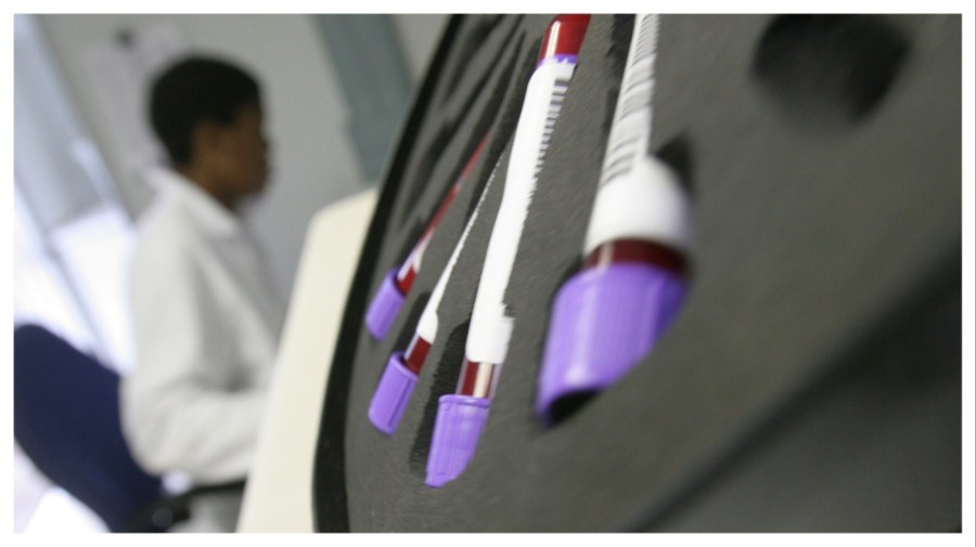 Trump aid freeze disrupts global HIV/AIDS fight