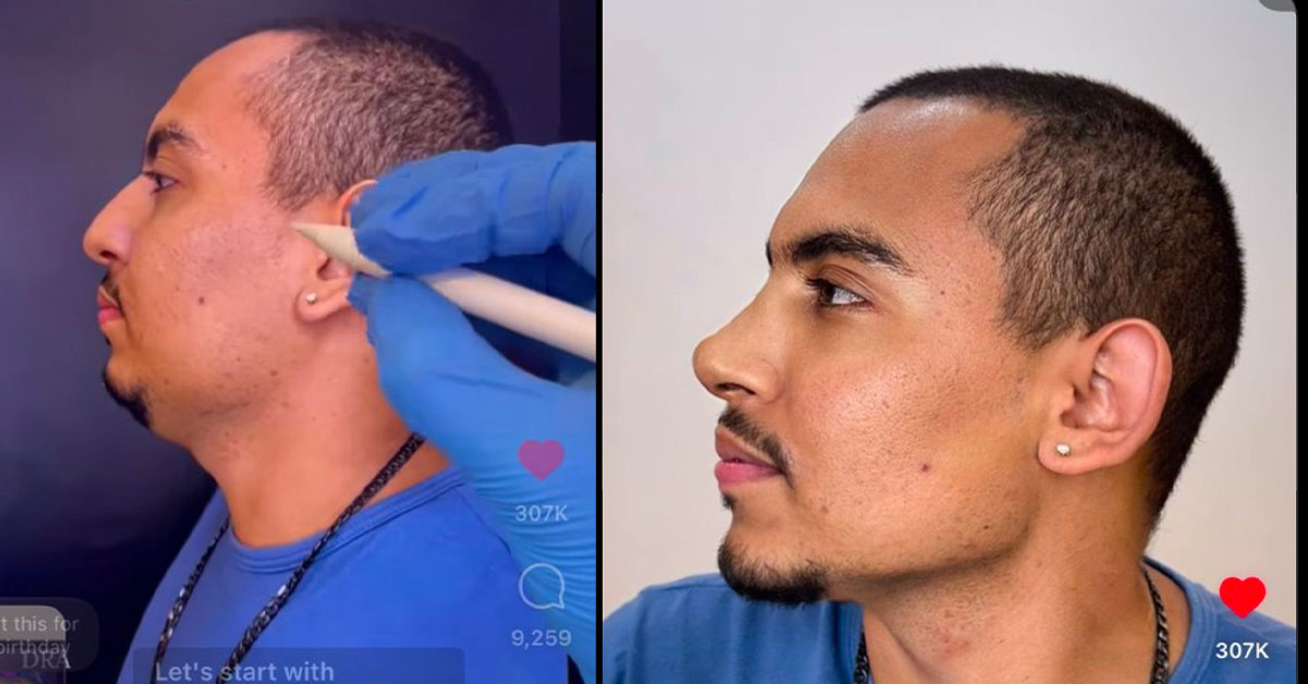 32 Before and After Surgery Pics That Don't Look Real