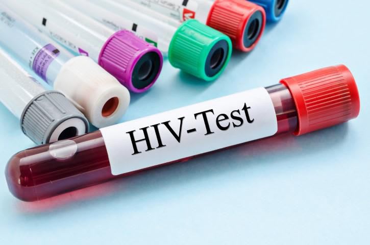 Nigeria set to begin production of HIV/AIDS test kits, anti-retroviral ...