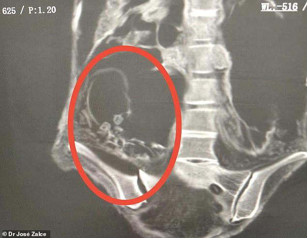 Experts studying 'alien mummies' claim bodies are '100% real'