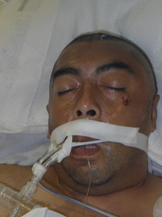 LA Hospital Needs Help ID’ing John Doe Patient
