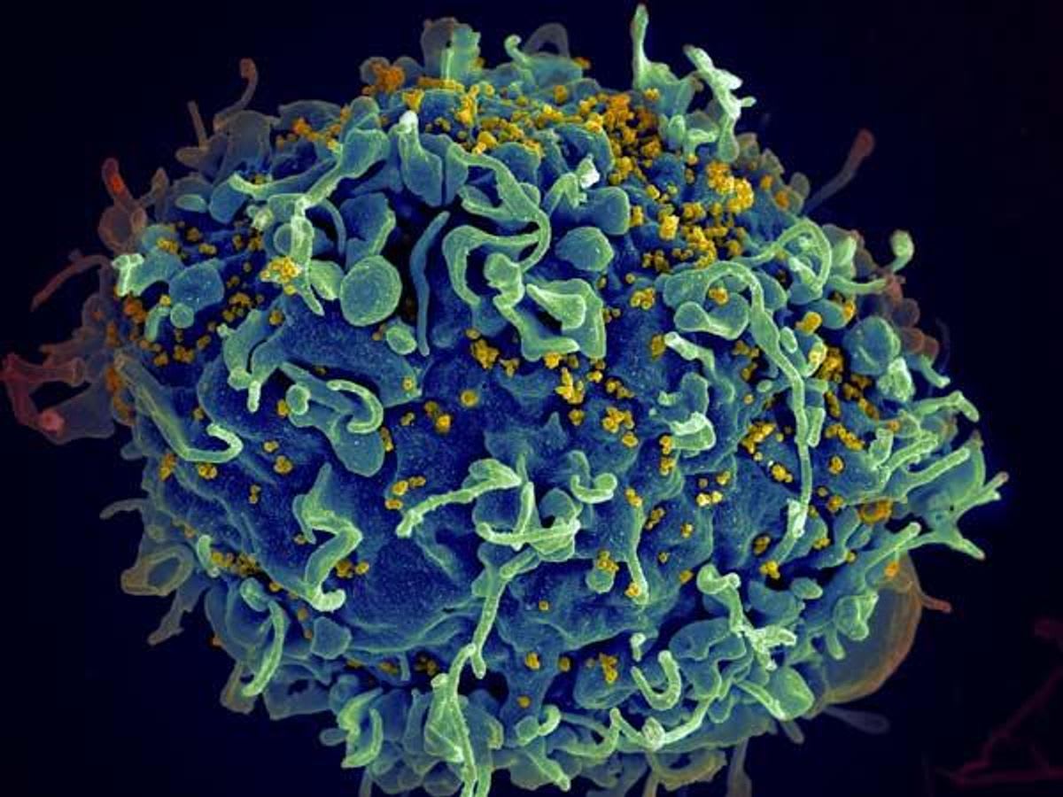 EBC-46 Shows Tremendous Potential To Help Eradicate HIV