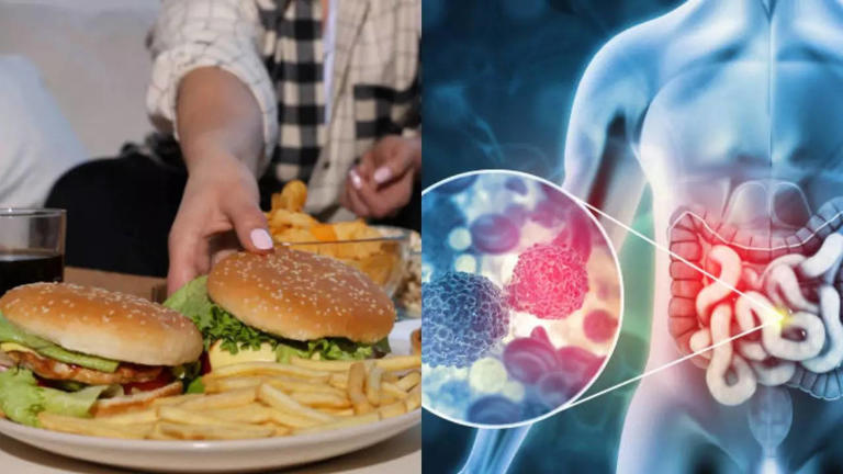 These Everyday Foods May Be Linked To Gastrointestinal Cancer! Expert Warns These Everyday Foods May Be Linked To Gastrointestinal Cancer! Expert Warns
