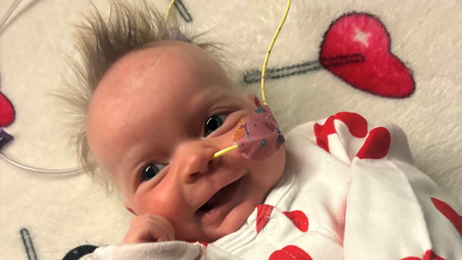 Mum of baby with rare blood disorder urges people to sign stem cell ...