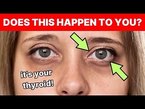 This Is How Thyroid Issues Begin and No One Tells You | Signs and Symptoms of Hypothyroidism