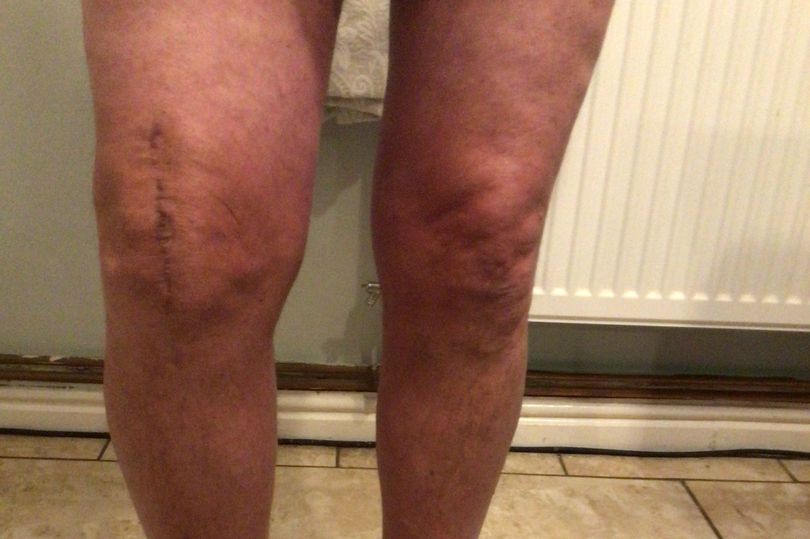 'I had to wait seven and a half years for a routine operation and it ...