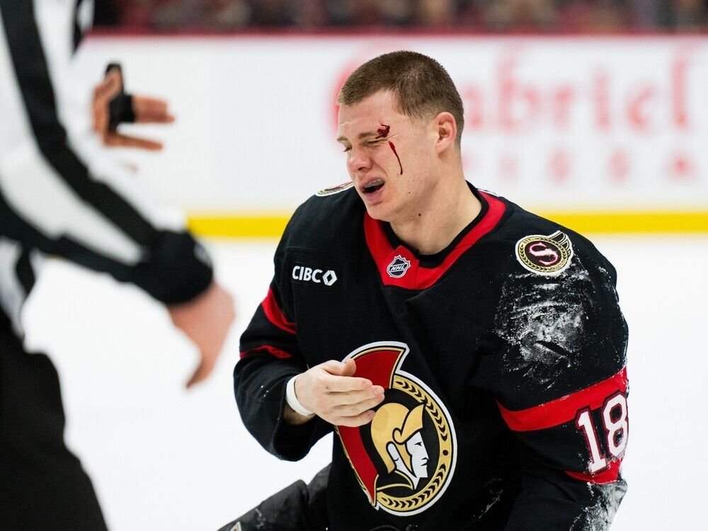 Minnesota's Ryan Hartman facing discipline after attack on Senators ...