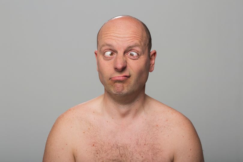 Spurs fans crowned biggest slapheads with bald Arne Slot's Liverpool in ...