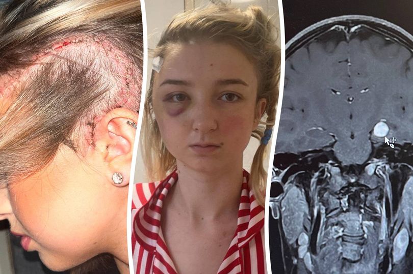 Hull teenager diagnosed with skin cancer twice and two brain tumours ...