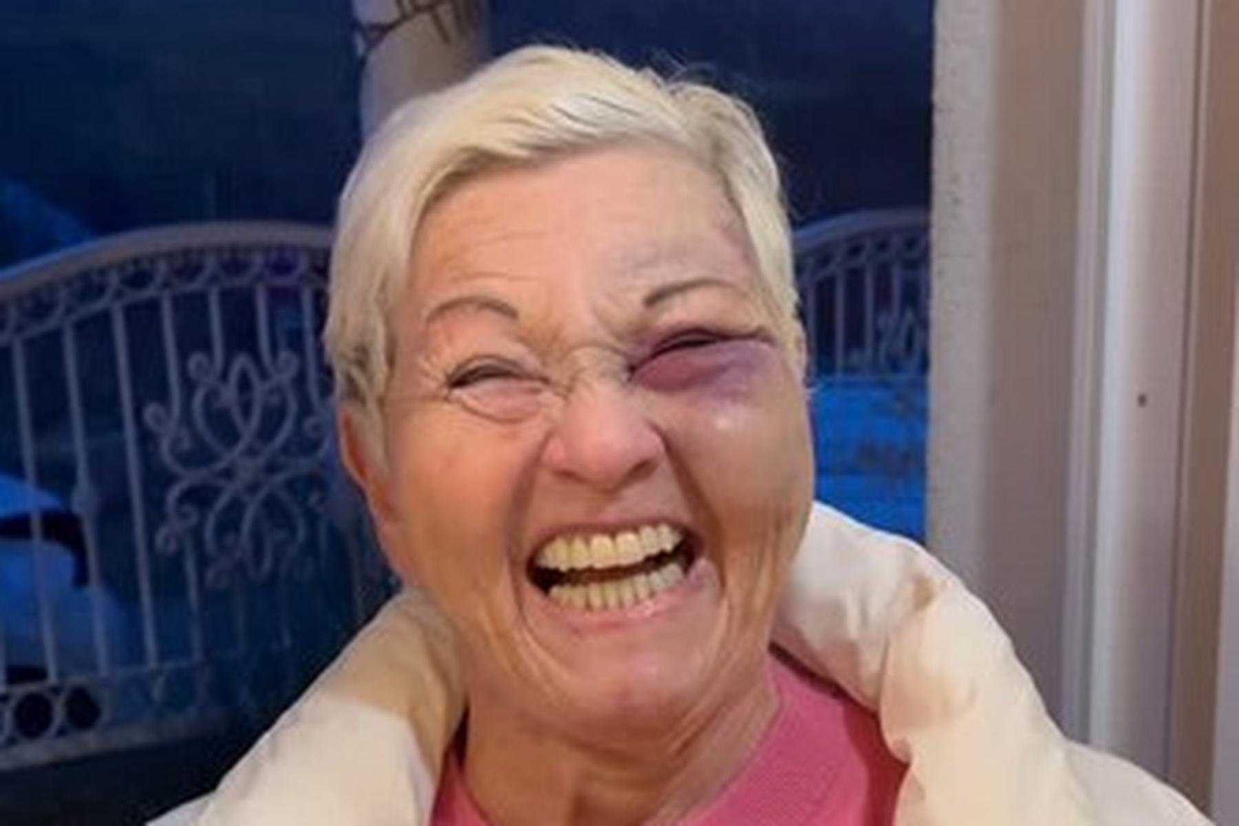 „Boxkampf gegen einen Yeti verloren“: Jazz Gitti holte sich in ...