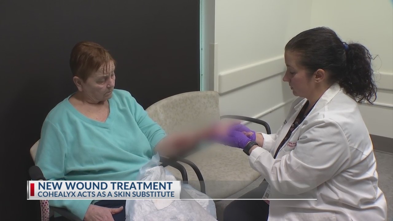 New Wound Treatment