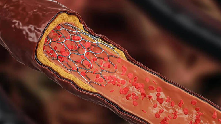 Top Springbok set for career-defining surgery after horror injury