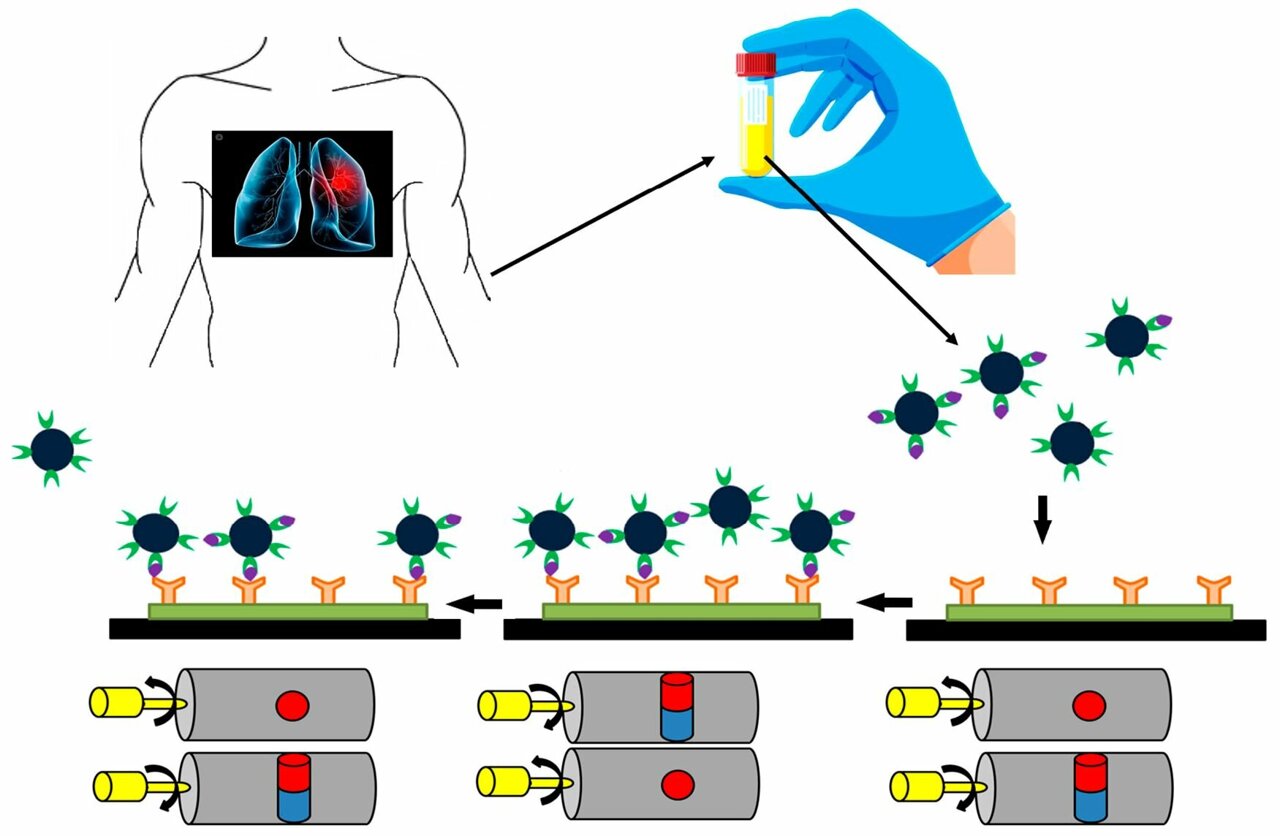 Screening device detecting lung cancer biomarkers shows promise for ...