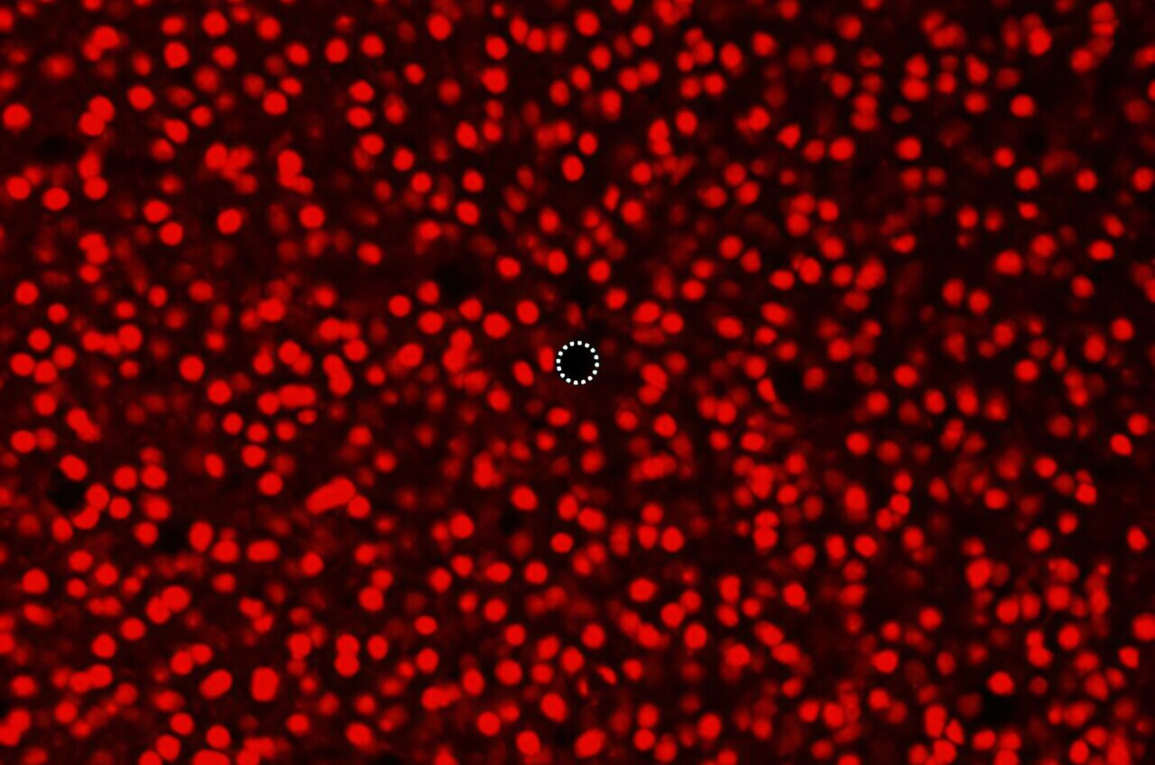 Microneedle electrode-based device overcomes long-standing challenges ...