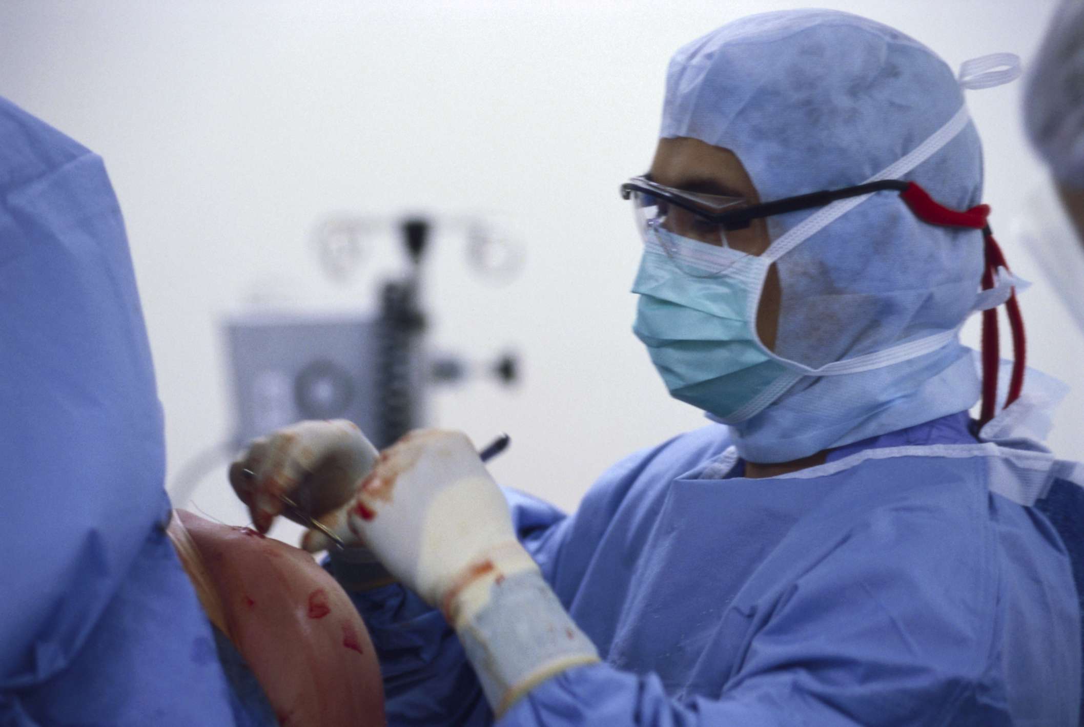 Rotator Cuff Repair Surgery: Everything You Need to Know