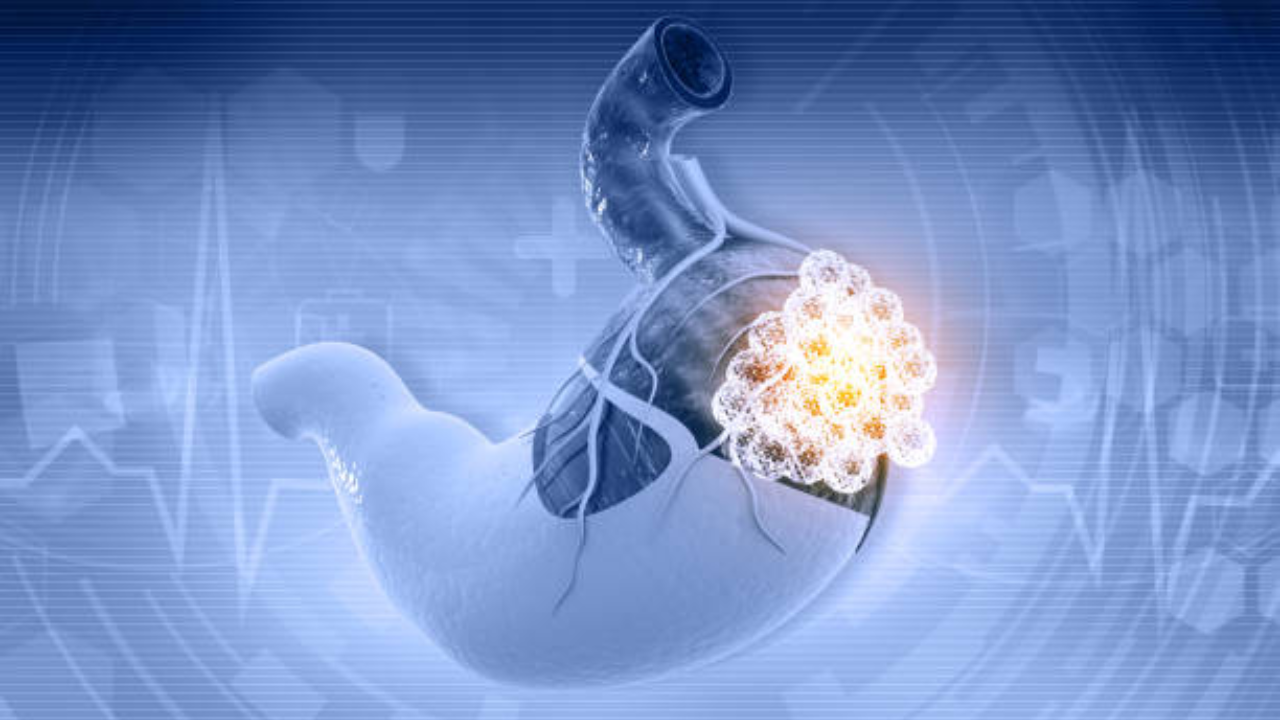 Understanding rare cancers and raising awareness for the overlooked