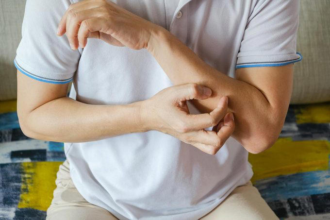 10 Warning Signs of Mold Toxicity, According to an Air Quality Expert