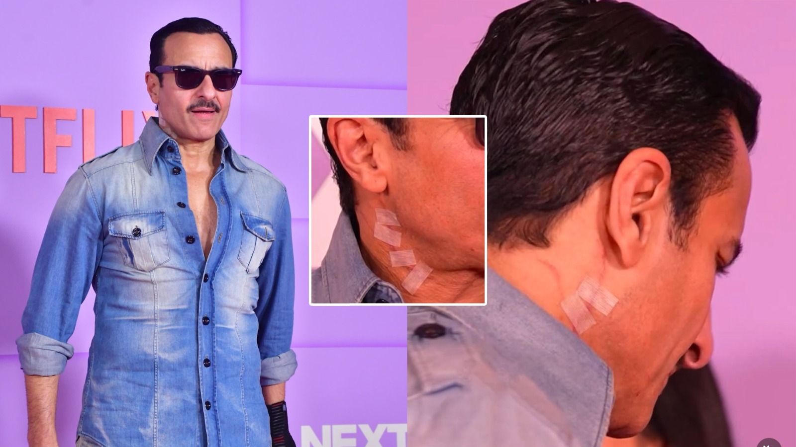 Saif Ali Khan Stabbing Attack: Actor's Neck Scar Photos Go Viral Amid ...