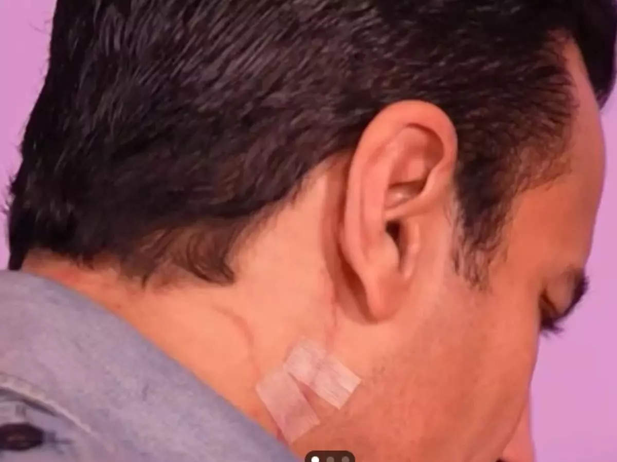 First look of Saif Ali Khan's scars from knife attack puts internet's ...