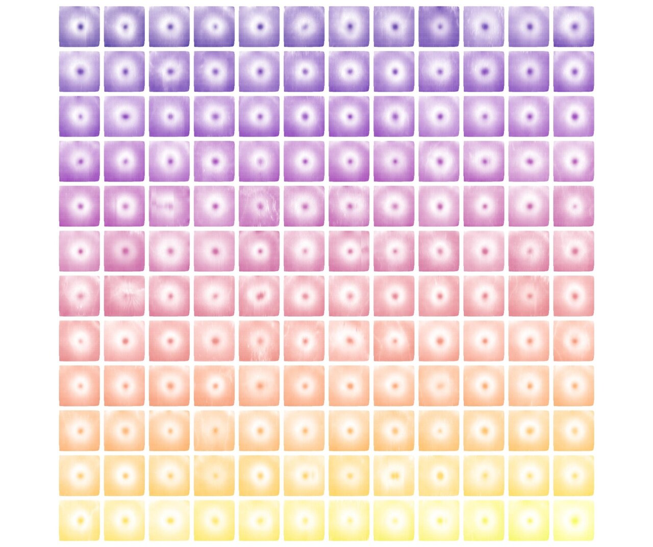 All in the eyes: High-resolution retinal maps aid disease diagnoses