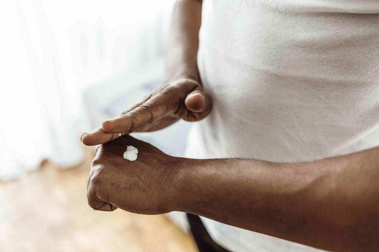 How to Recognize and Treat a Sun Rash