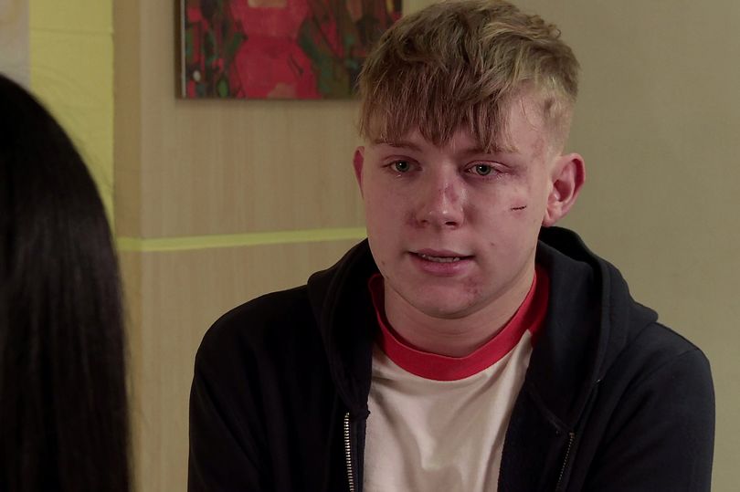 Coronation Street's Max Turner star opens up on show ‘first’ as ...