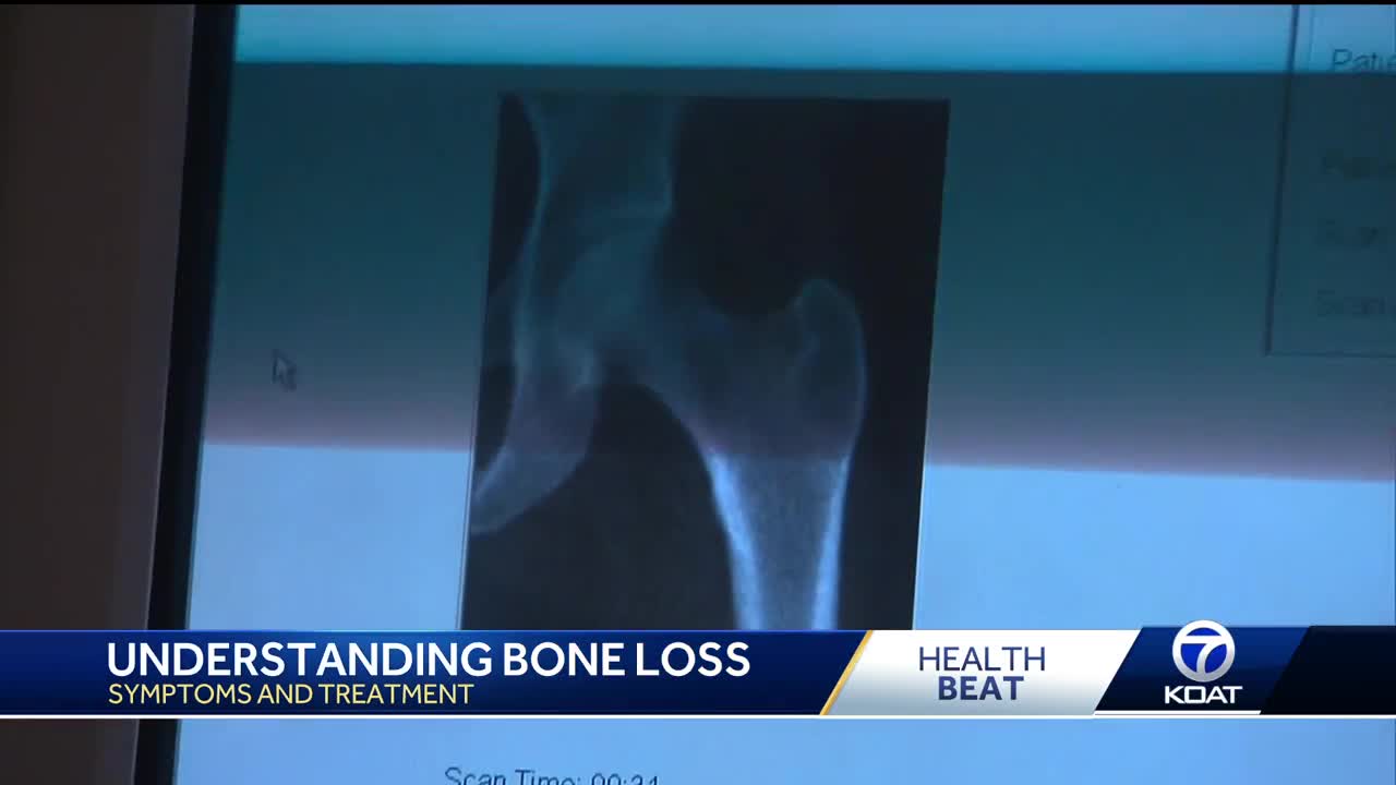 Health tips for avoiding bone loss